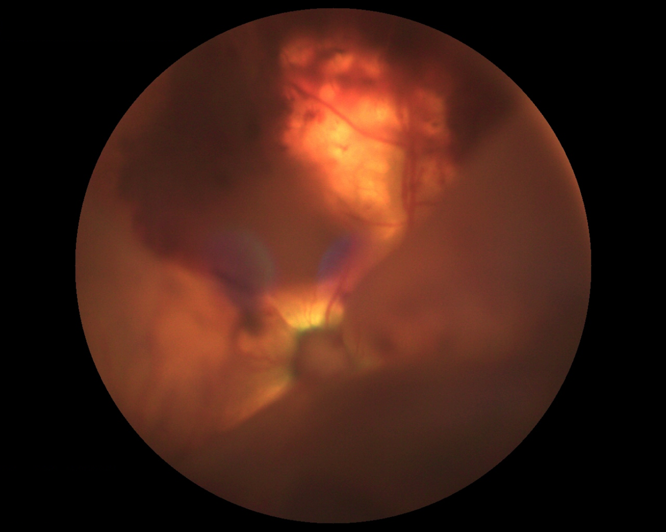 Décollement rétinien | Vision Animale